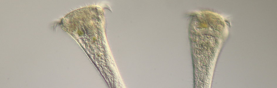 Simple Cells with a Complex Defense